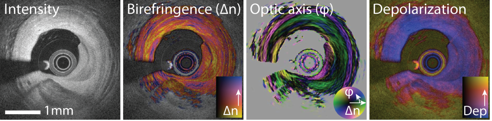 Percutaneous and Interstitial Imaging - OCT Research