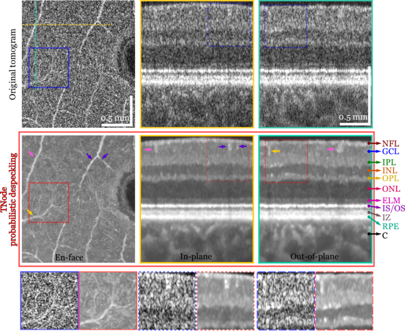 Probabilistic OCT Post-Processing Methods - OCT Research