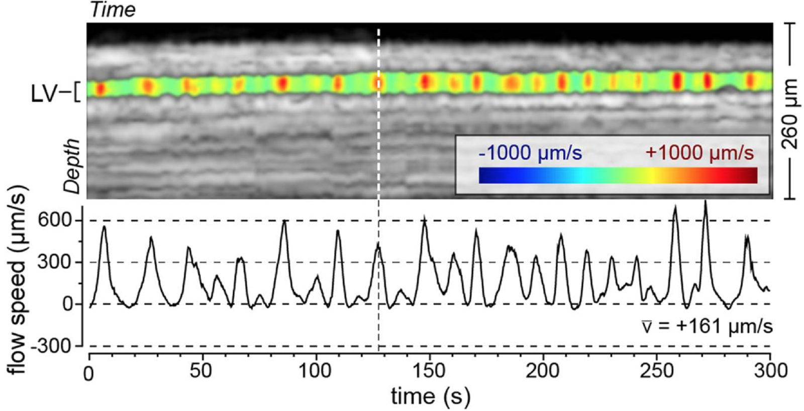Quantitative In Vivo Lymph Flow Imaging by Doppler OCT - OCT Research